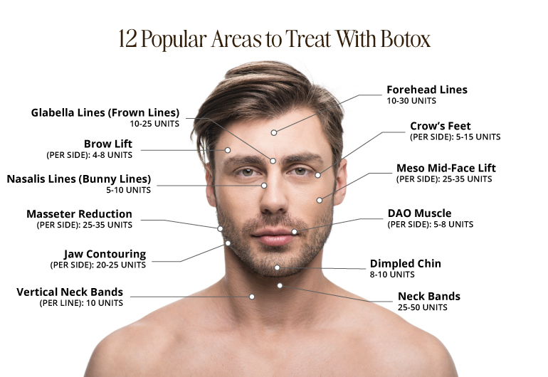 How Many Units of Botox Do I Need?